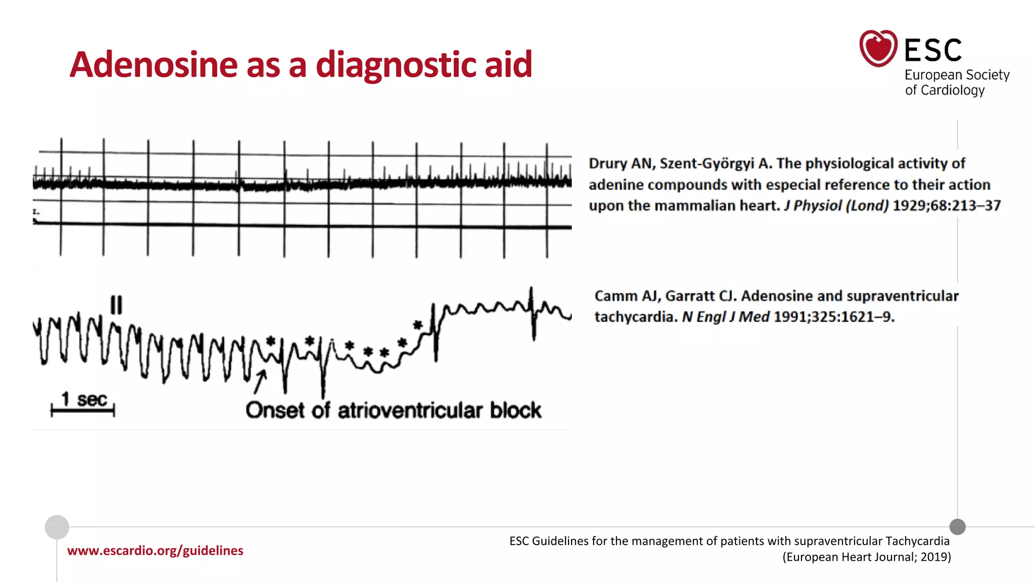 Metode Diagnostik SVT .pdf