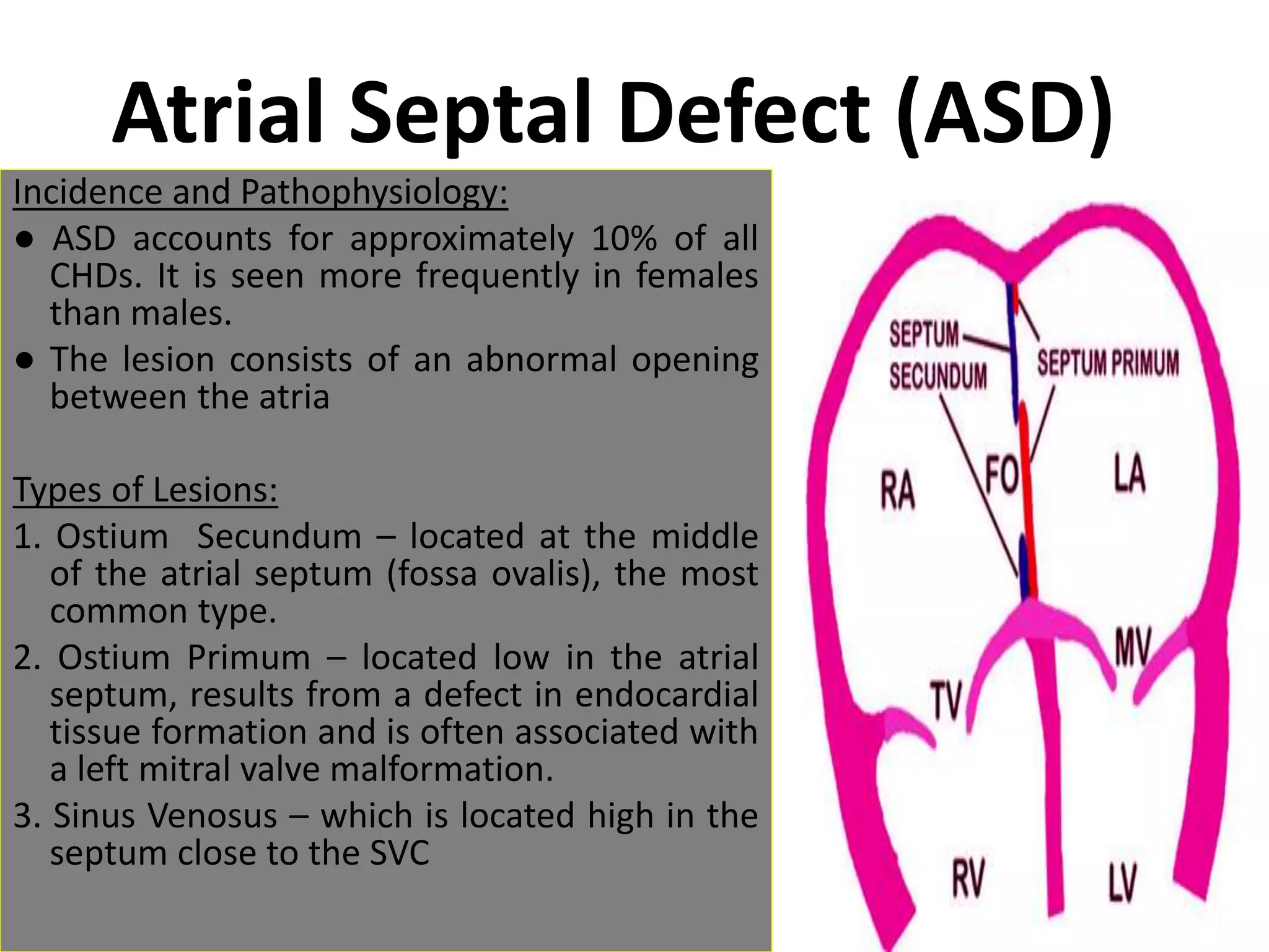 Acynotic heart defects | PPTX