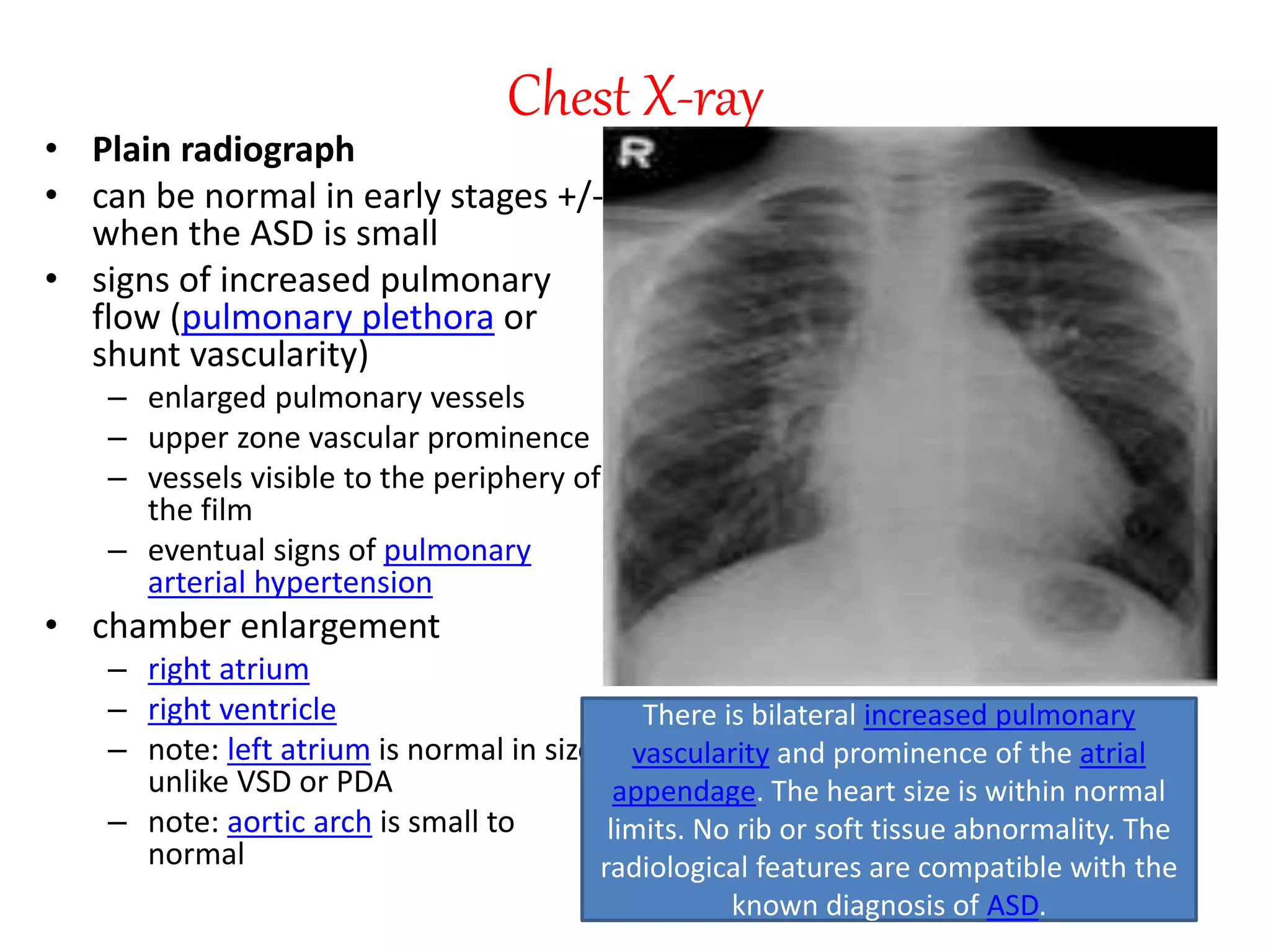 Acynotic heart defects | PPTX