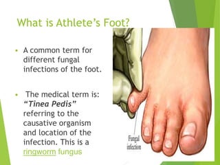 Slides athletes footv2 | PPT