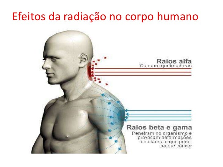 Slides de radiação