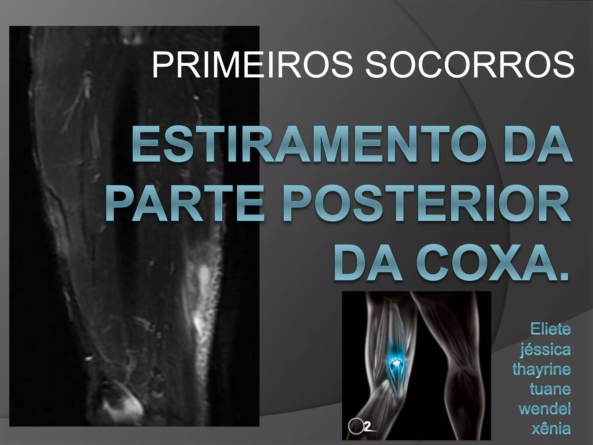 UEMG - Estiramento da parte posterior da coxa slides - primeiros ...
