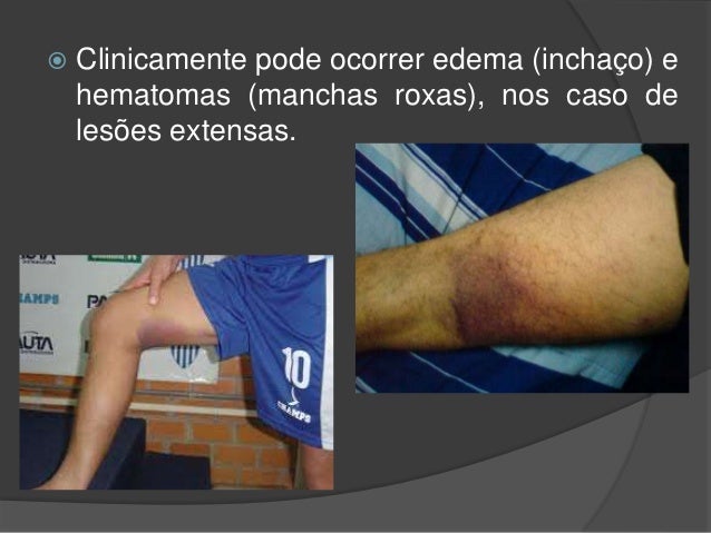 UEMG - Estiramento da parte posterior da coxa slides - primeiros soco…