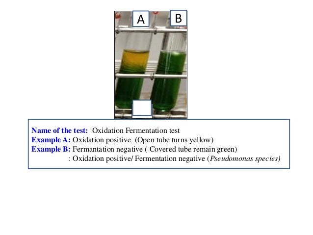 Oxidation Fermentation Test