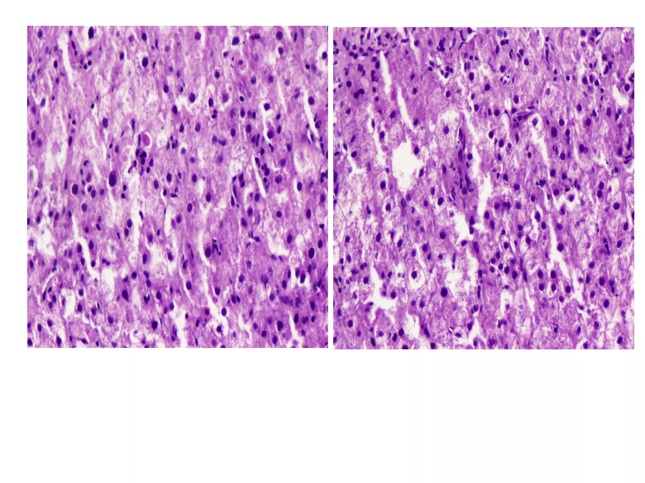 Slides for liver slide seminar,Pathology CME,Govt.Medical College ...