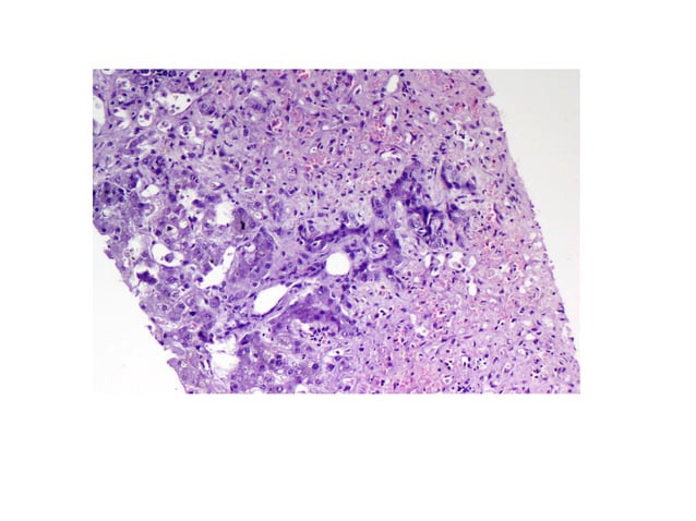 Slides for liver slide seminar,Pathology CME,Govt.Medical College ...