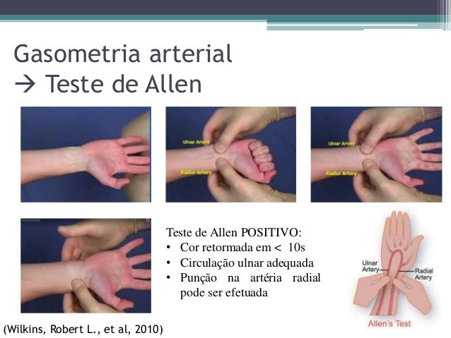 Gasometria Arterial