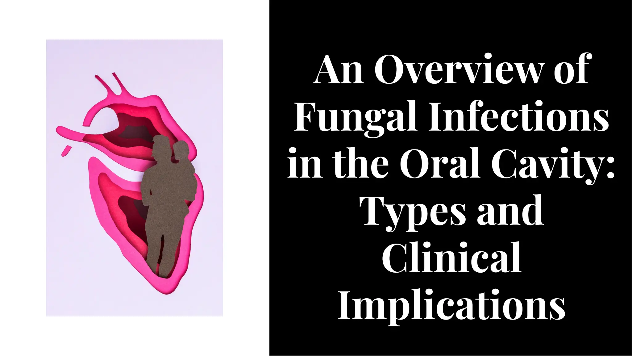 intro and types of fungal infection in oral cavity | PPT