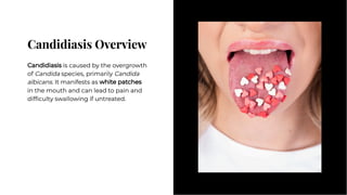 intro and types of fungal infection in oral cavity | PPT