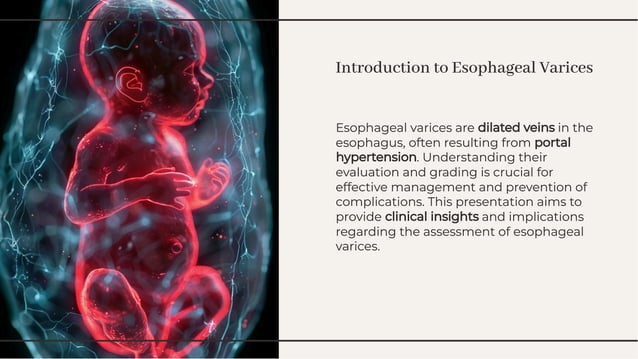 slidesgo-comprehensive-evaluation-and-grading-of-esophageal-varices ...
