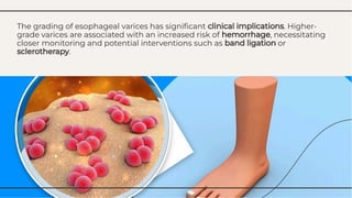 slidesgo-comprehensive-evaluation-and-grading-of-esophageal-varices ...