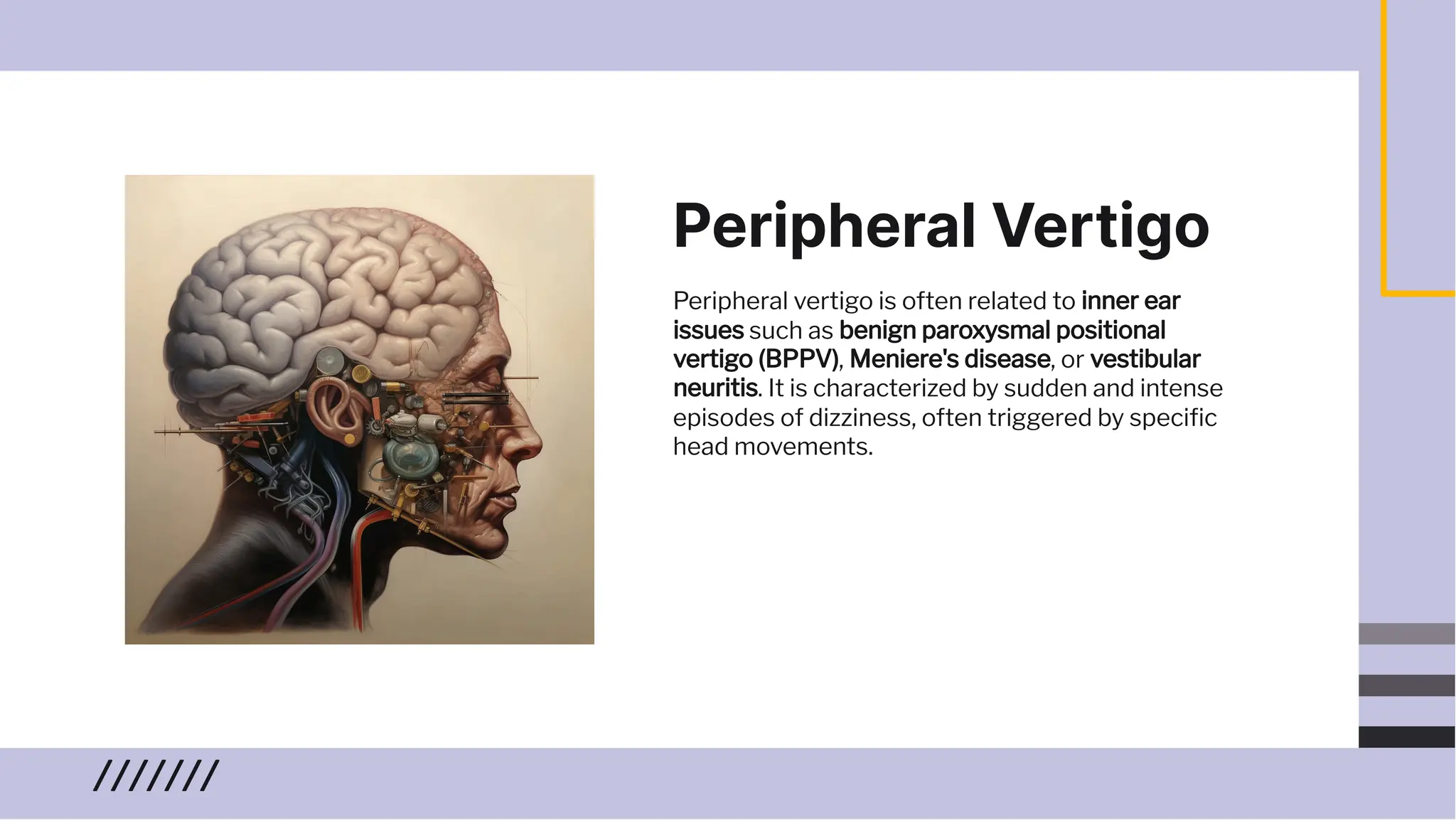 slidesgo-different-types-of-vertigo- of my study of analitical review.pdf