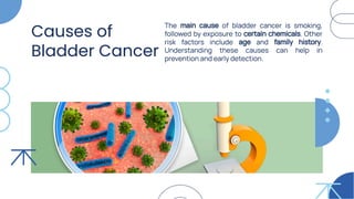 Understanding Bladder Cancer Causes Symptoms and Prevention | PDF