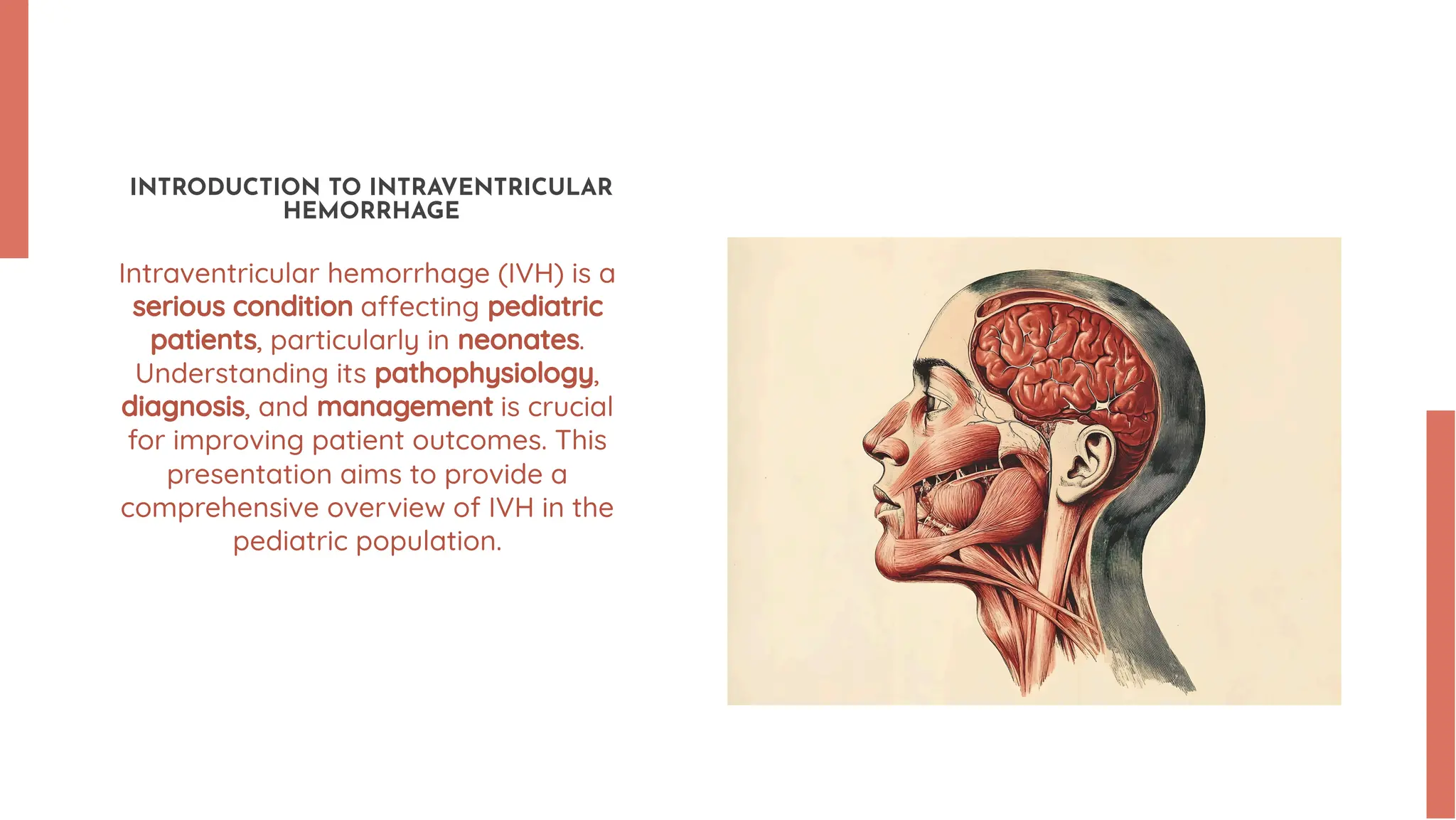 Intraventricular Hemorrhage in pediatrics | PDF
