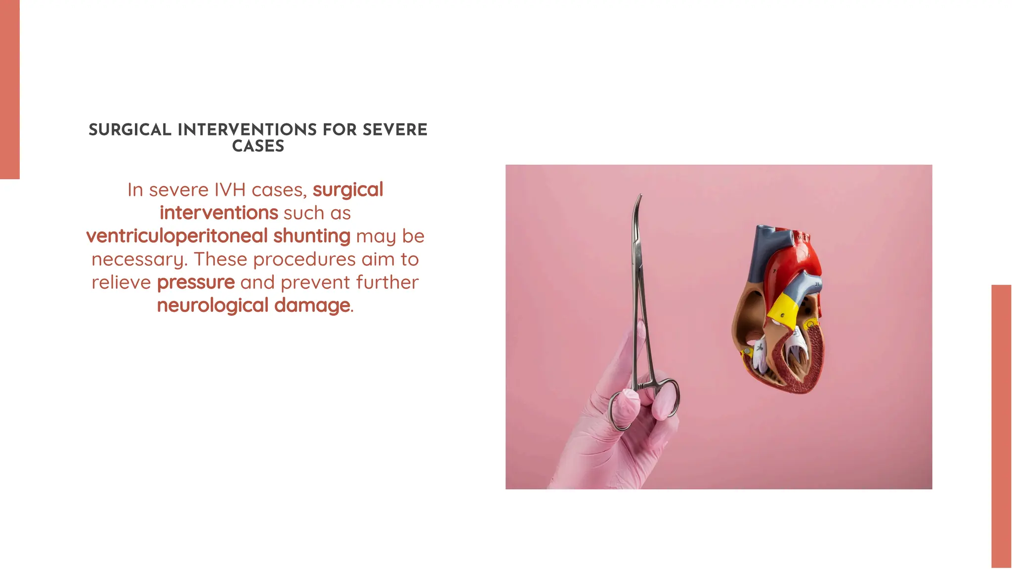 Intraventricular Hemorrhage in pediatrics | PDF