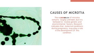 slide an go understanding - microtia - advances | PPTX