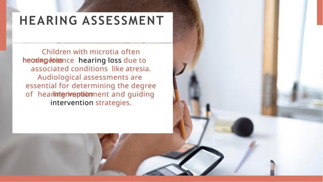 slide an go understanding - microtia - advances | PPT