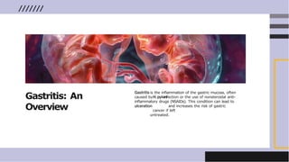 understanding-the-physiology-of-acid-peptic-disease-mechanisms-and-implications ...