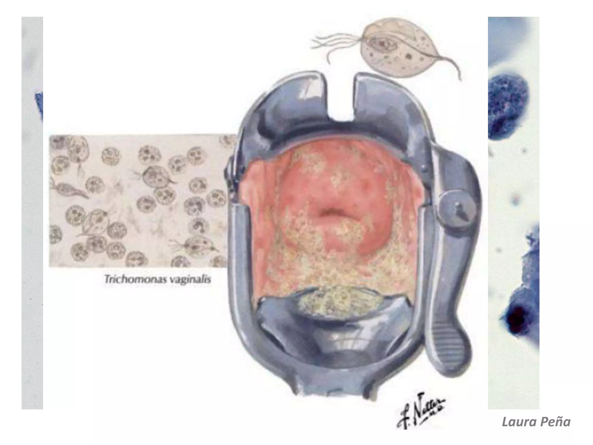 Leucorrea | PPTX | Reproductive Health | Diseases and Conditions
