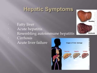 Digestion System's Diseases | PPTX