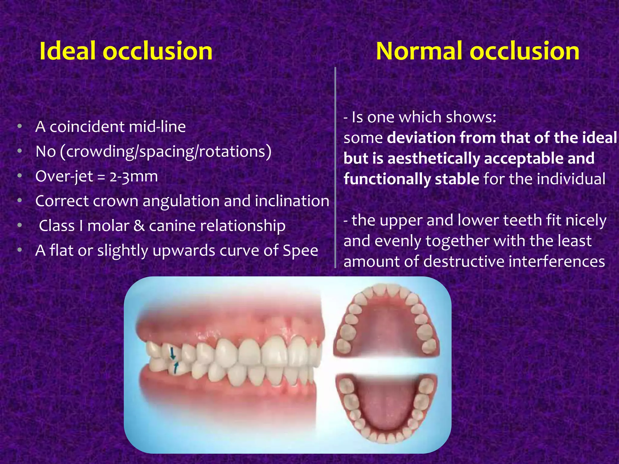 Classification of Malocclusion | PPTX