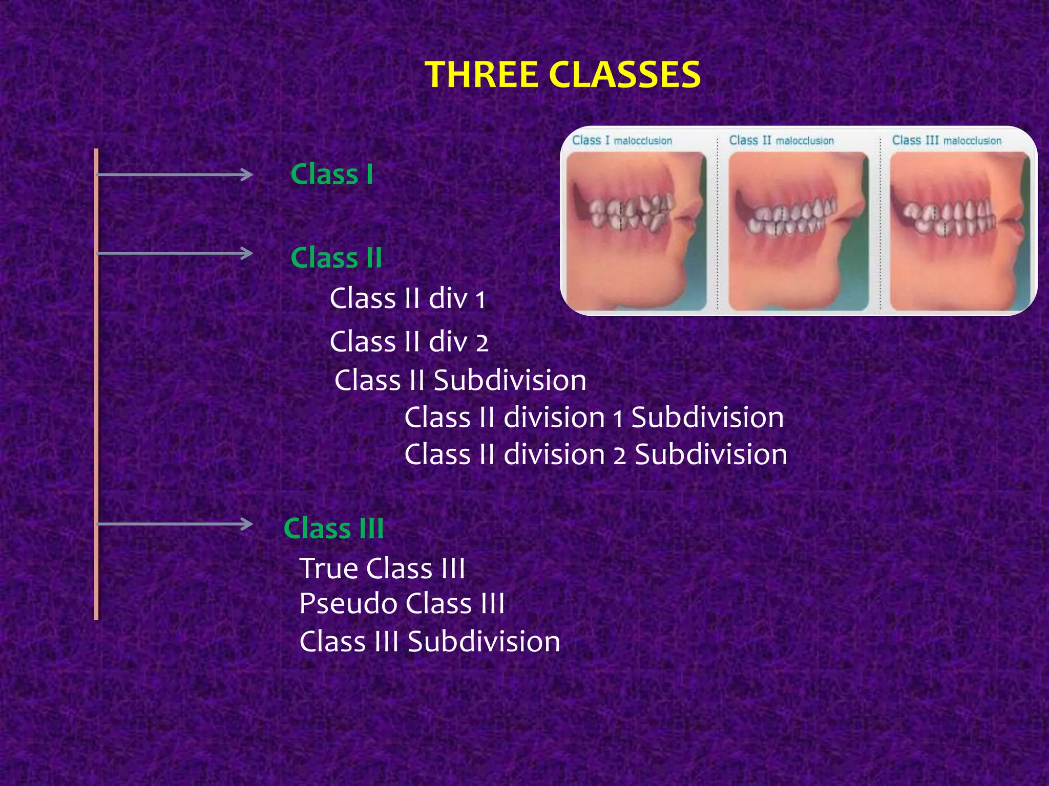 Classification of Malocclusion | PPTX