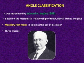 Classification of Malocclusion | PPTX