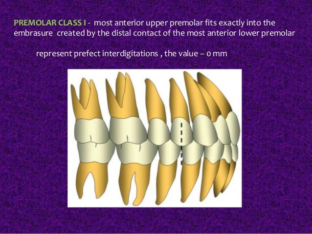 Classification of Malocclusion