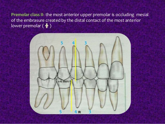 classification of malocclusion