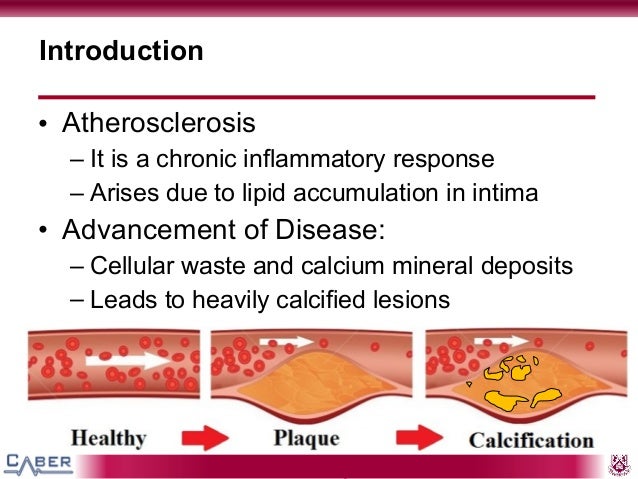 Atherosclerosis of the Femoral Arteries