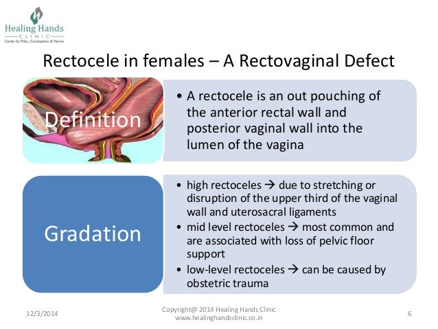 Obstructed Defecation Syndrome Diagnosis And Surgical Treatment