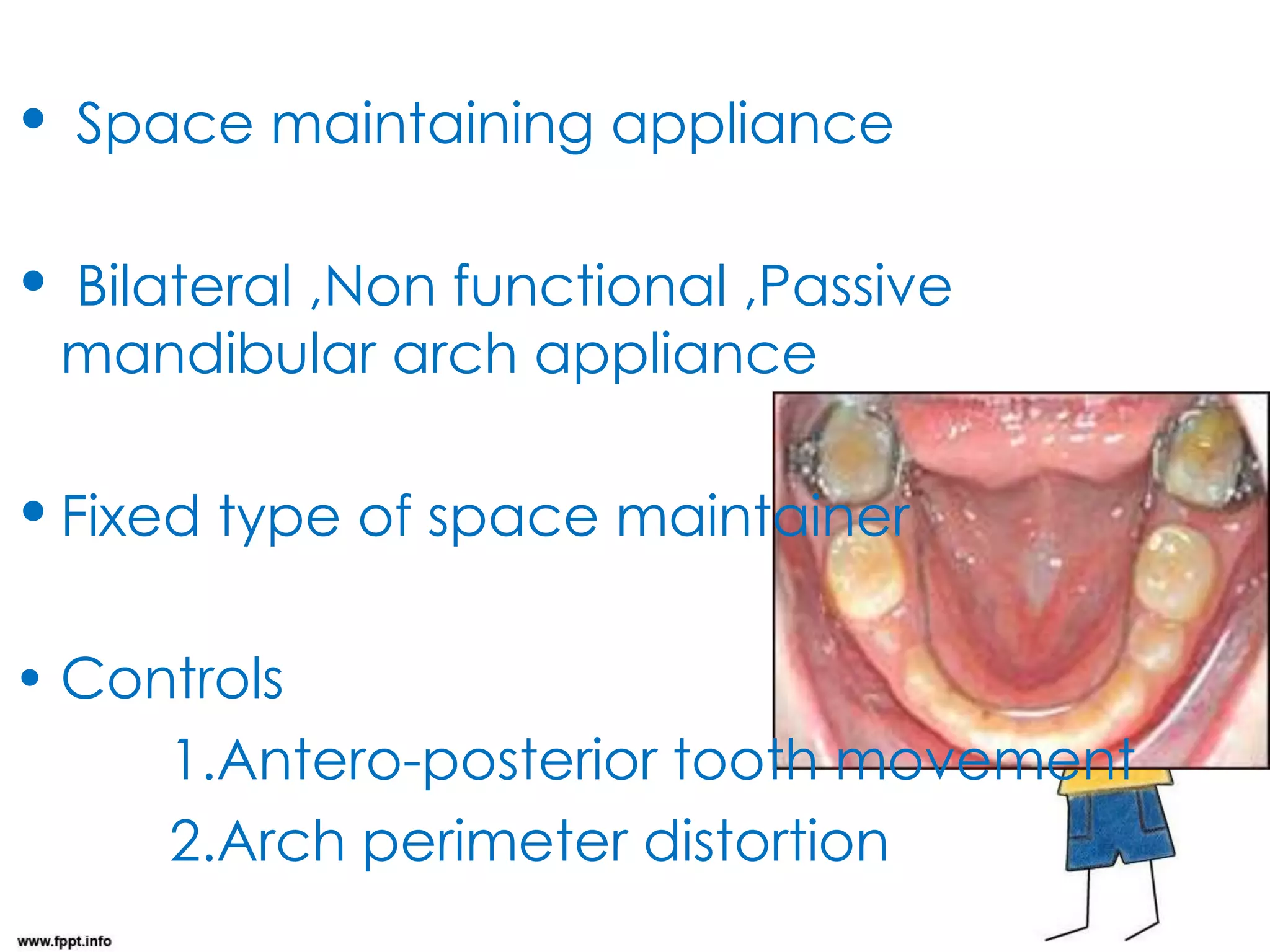 lingual holding arch space maintainer | PPTX