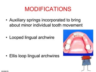 lingual holding arch space maintainer | PPTX