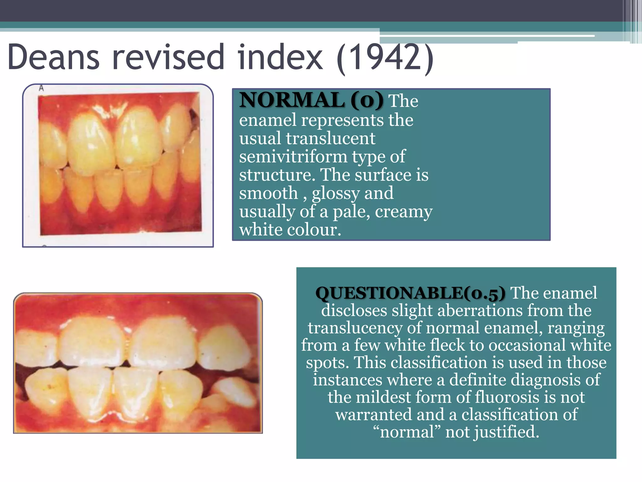 fluoride indices in dentistry | PPTX