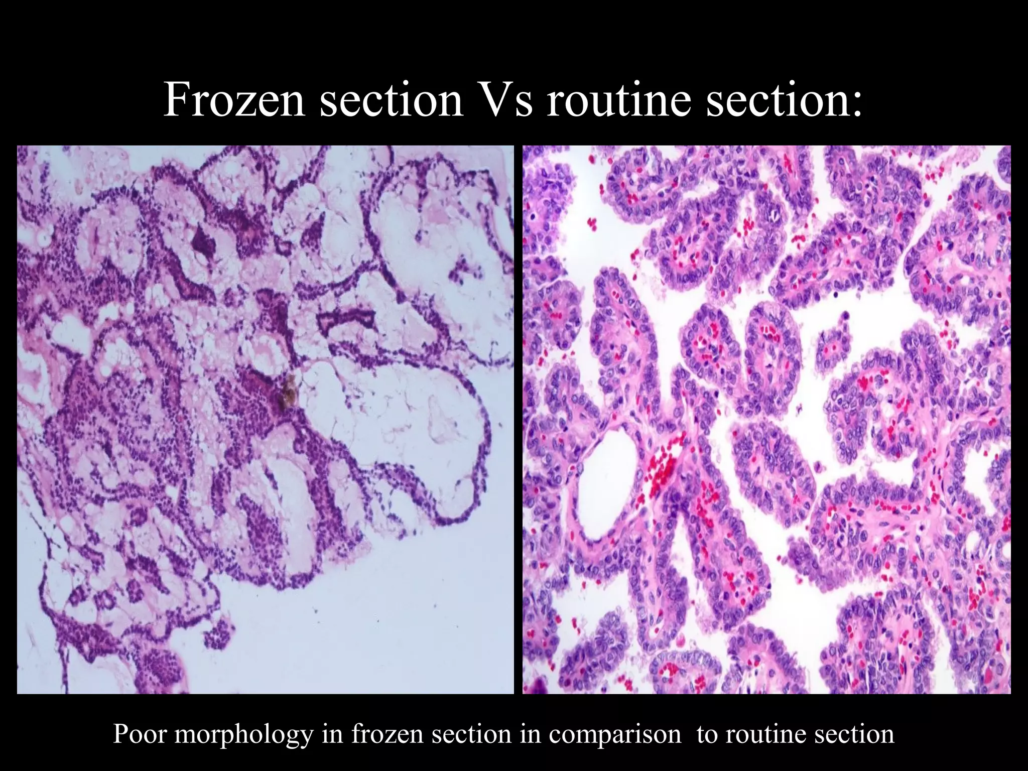Frozen Section Basics | PPT