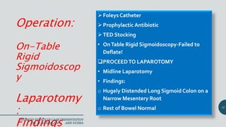 Sigmoid Volvulus Case Presentation 2019 التواء ألقولون | PPTX
