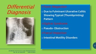 Sigmoid Volvulus Case Presentation 2019 التواء ألقولون | PPTX
