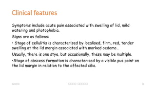 Eye lid disorders | PPT