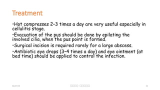 Eye lid disorders | PPT
