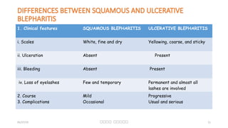 Squamous Blepharitis