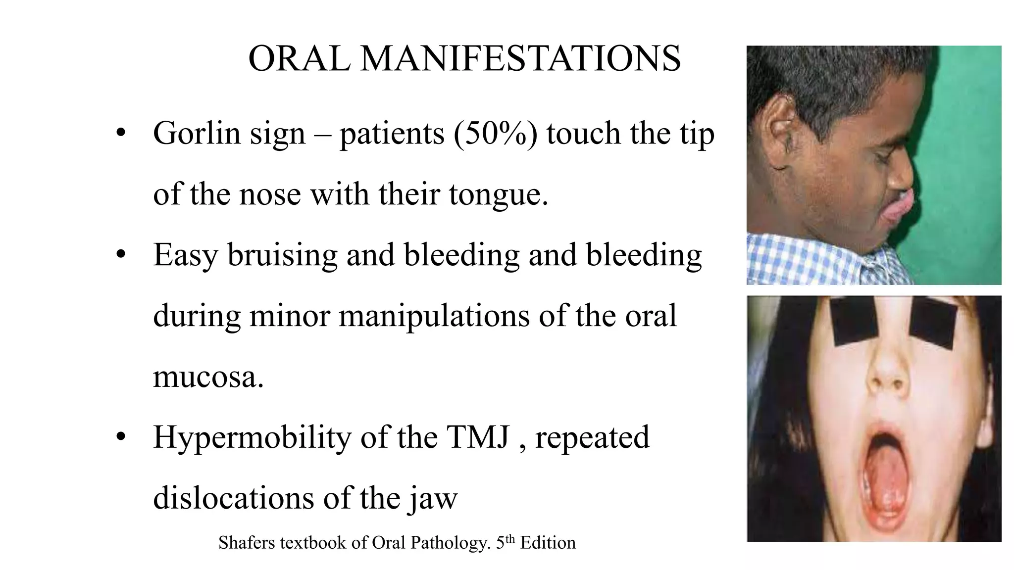 BLEEDING AND CLOTTING DISORDERS | PPTX