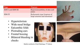 BLEEDING AND CLOTTING DISORDERS | PPTX