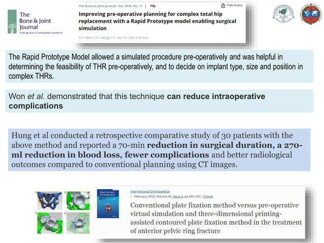 3D Printing and 3D Models as a part of Preplanning for Complex Total ...
