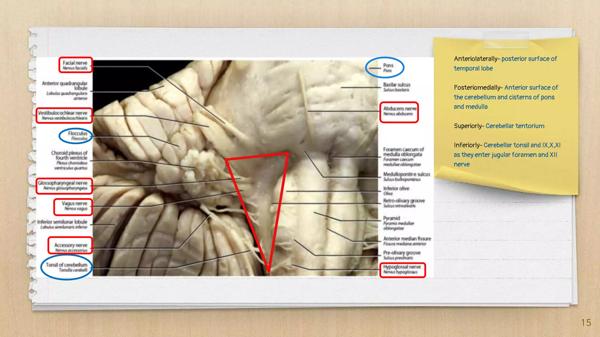 Vestibular schwannoma (acoustic neuroma) surgical anatomy and ...