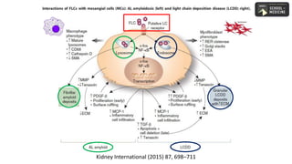 Dysproteinemias Related Renal Disorders, Monoclonal Gammopathy ...