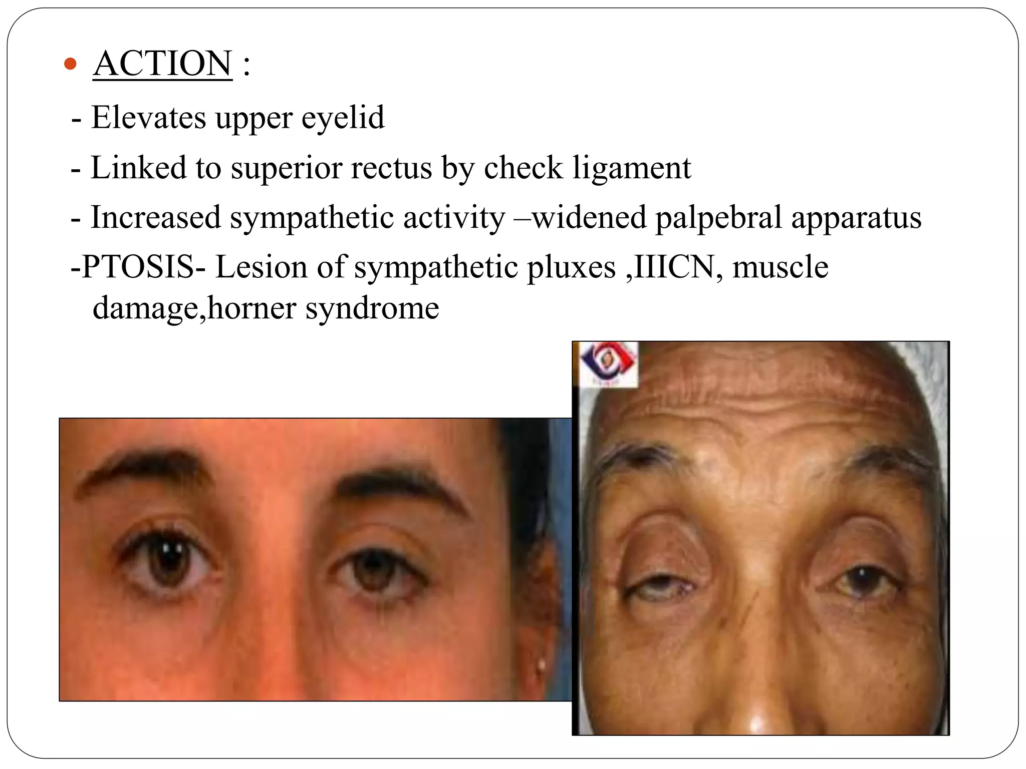 MUSCLES OF FACIAL EXPRESSION | PPTX