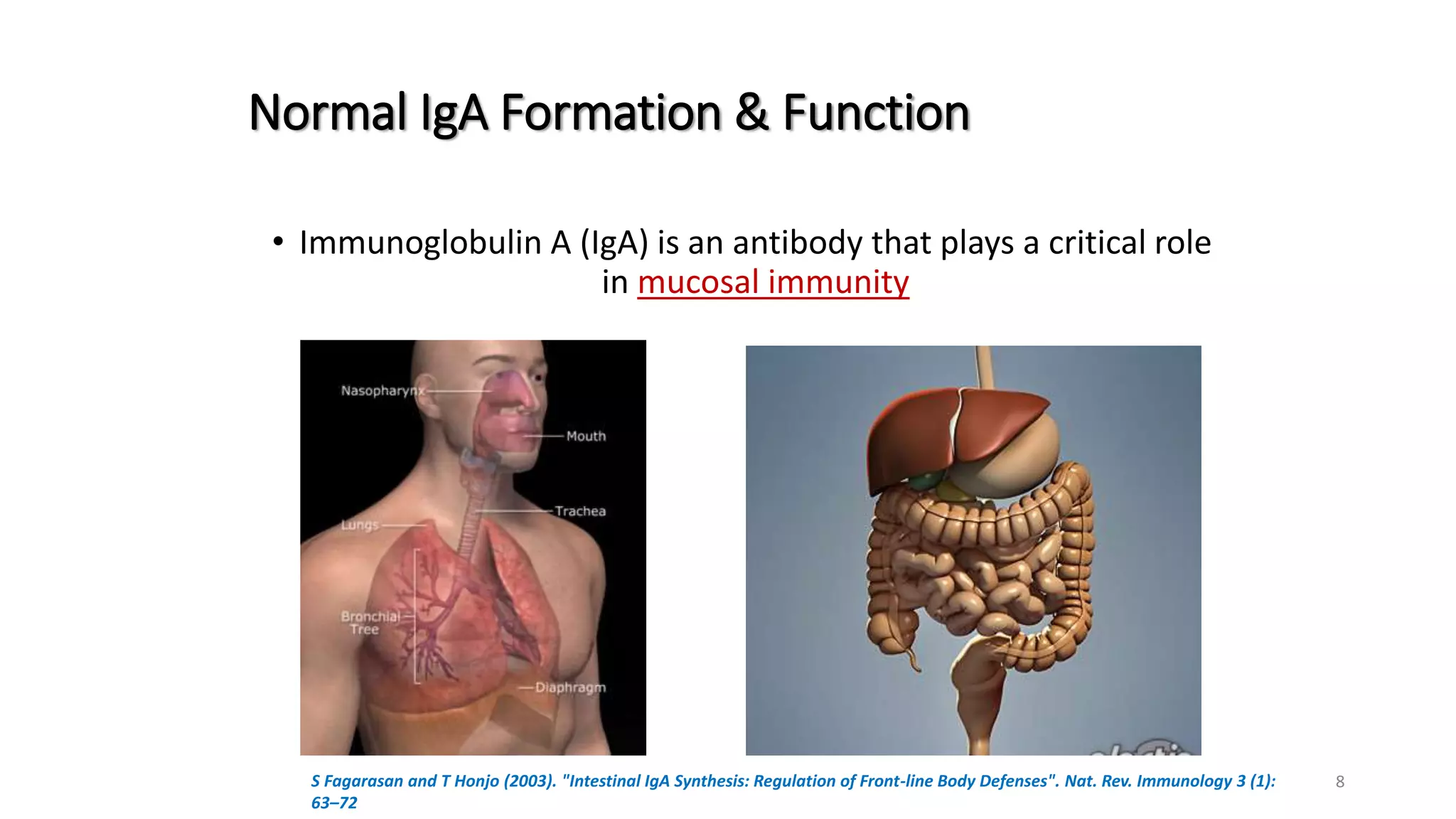 IgA Nephropathy (KDIGO 2021 Guidelines) - Dr. Gawad | PPTX