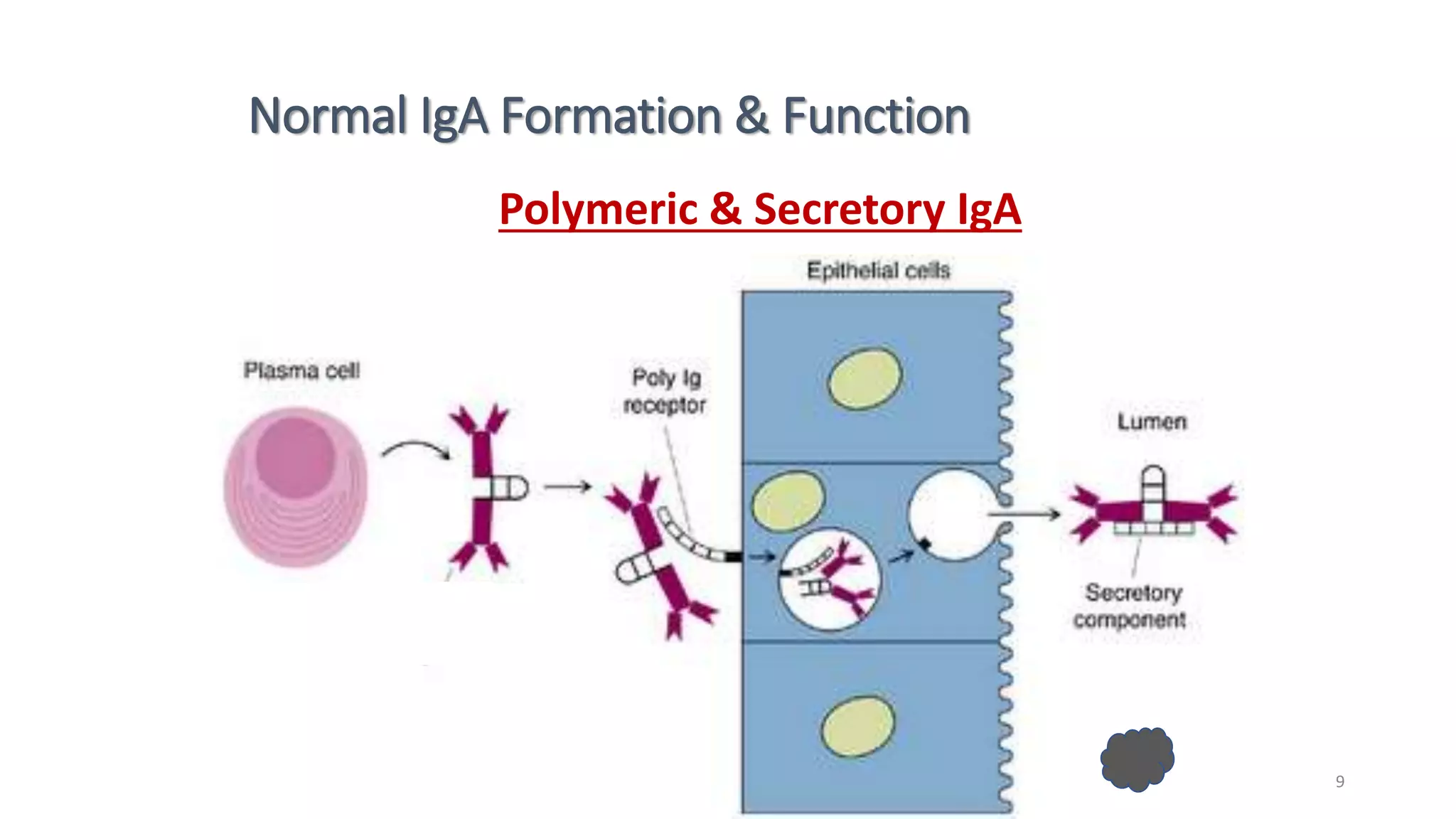 IgA Nephropathy (KDIGO 2021 Guidelines) - Dr. Gawad | PPTX