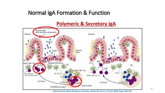 IgA Nephropathy (KDIGO 2021 Guidelines) - Dr. Gawad | PPTX | Digestive Disorders | Diseases and ...
