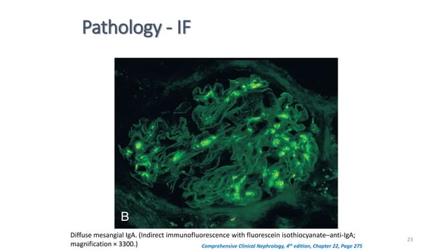 IgA Nephropathy (KDIGO 2021 Guidelines) - Dr. Gawad | PPTX | Digestive Disorders | Diseases and ...
